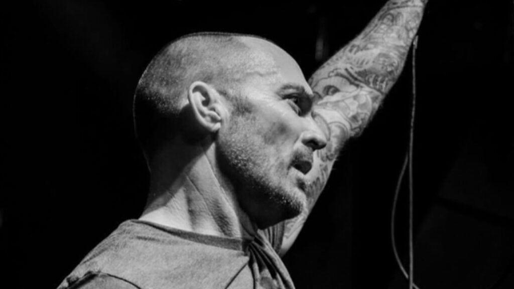 Snot Vocalist Andy Knapp Sustains 'Significant Leg Injury' In Stage ...